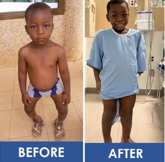 Mercer Health’s Surgery Center Setting for Life-Changing Treatment ...